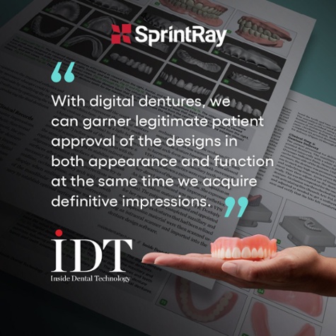 SprintRay 3D Printed Ceramic Crown: Scientific Studies Summary