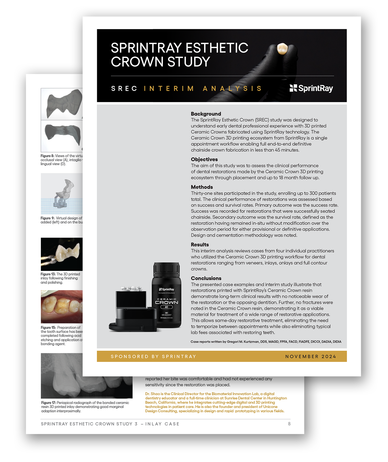SprintRay Esthetic Crown Study